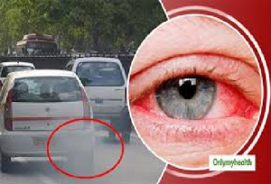 Air Pollution and Eye Diseases – Double Helical